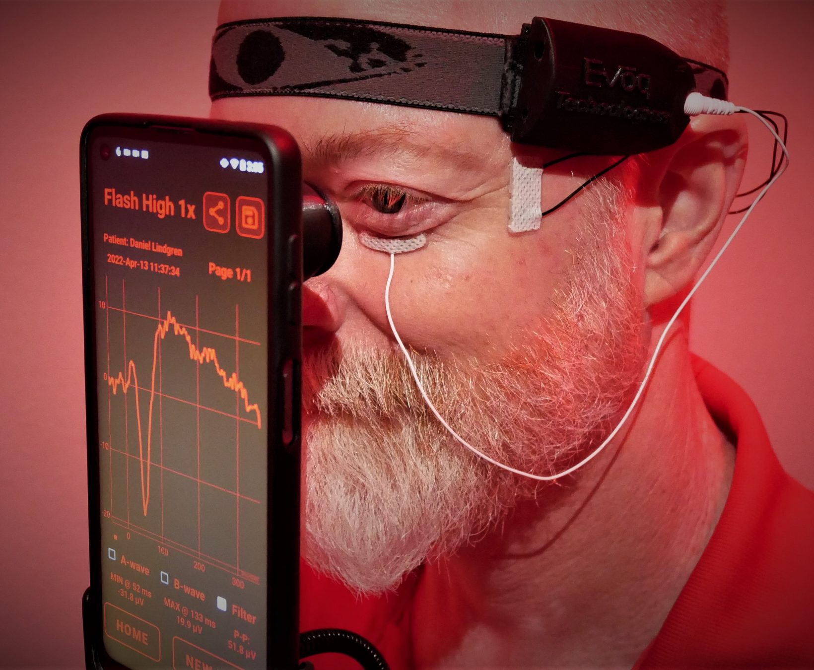 SmartERG R - Evoq Technologies